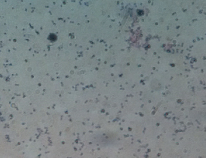 Enhanced Production of Ployhydroxybutyrate (PHB) Using the Marine ...