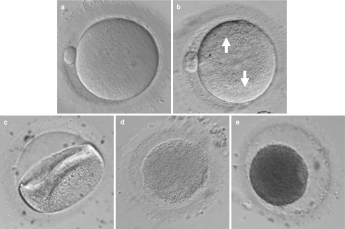 Handling and Assessing of Human Oocytes and Blastocysts After ...