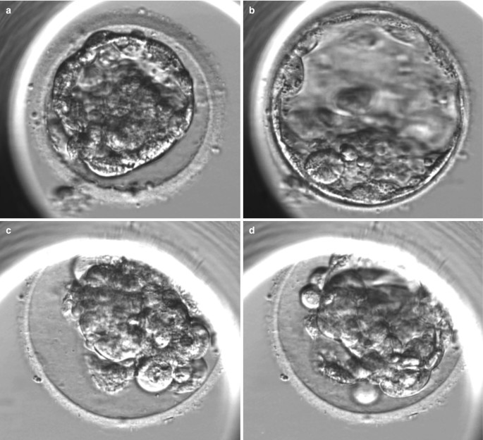 Handling and Assessing of Human Oocytes and Blastocysts After ...