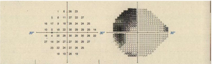 Not Seeing the Whole Picture | SpringerLink