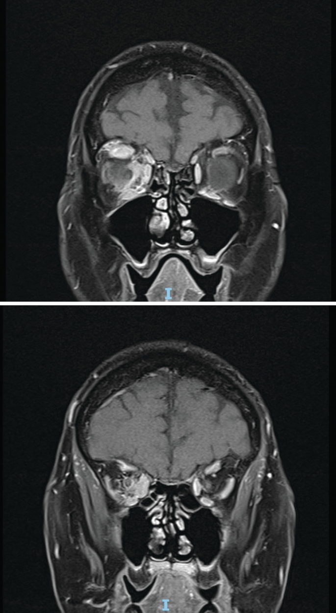 New Double Vision and Cancer History | SpringerLink