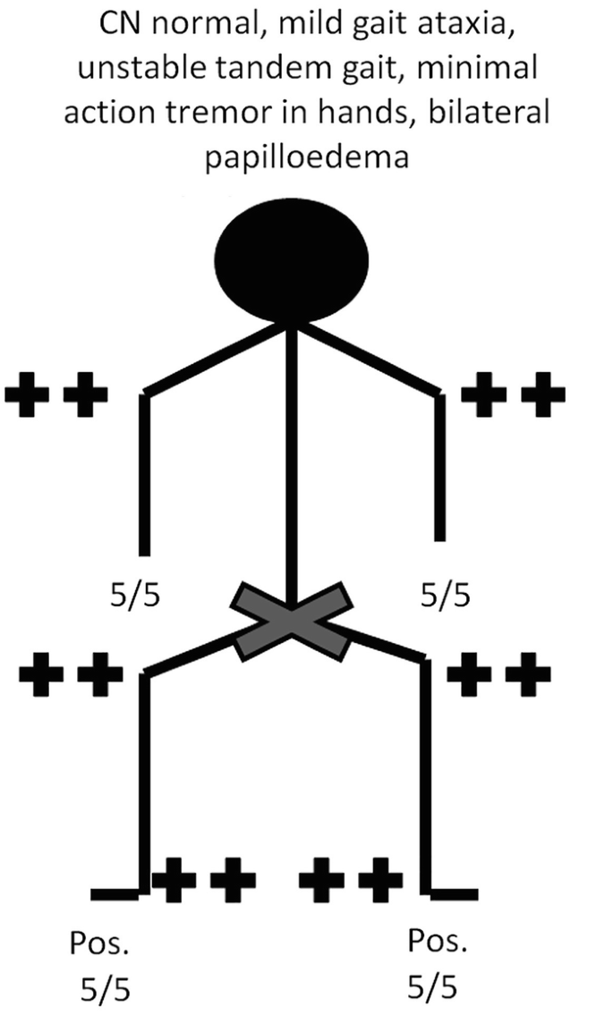 Unstable Gait, Headache and Increased Reflexes in a Young Man ...