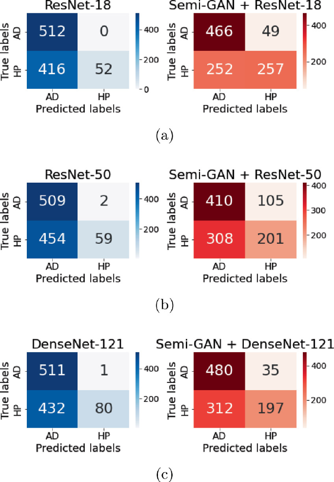 Semi-supervised Polyp Classification in Colonoscopy Images Using GAN | SpringerLink