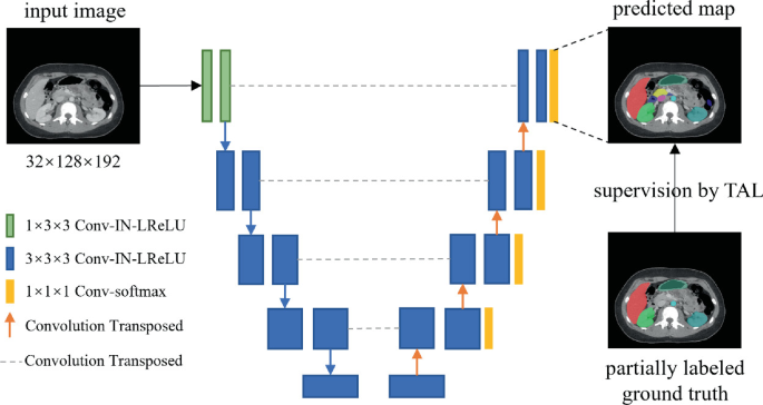 A Lightweight nnU-Net Combined with Target Adaptive Loss for Organs and ...