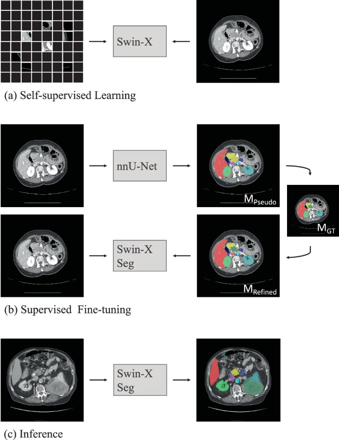 3D Swin Transformer for Partial Medical Auto Segmentation | SpringerLink