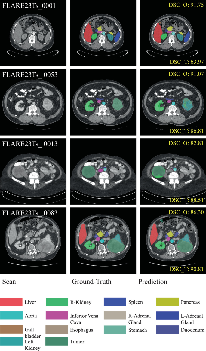 3D Swin Transformer for Partial Medical Auto Segmentation | SpringerLink