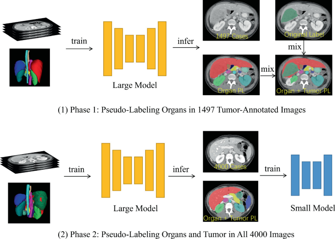 Exploiting Pseudo-labeling and nnU-Netv2 Inference Acceleration for Abdominal Multi-organ and ...