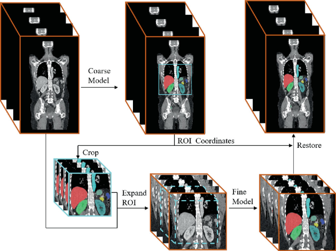From Whole-Body to Abdomen: Streamlined Segmentation of Organs and ...