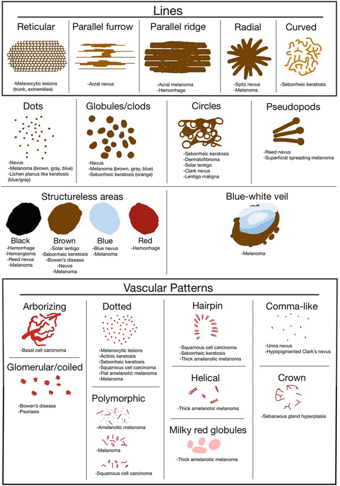Dermoscopy | SpringerLink