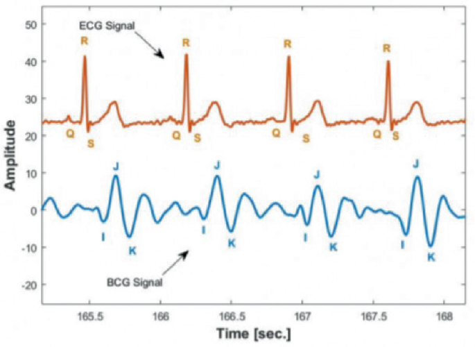 Signal Filtering and Peak Analysis of Ballistocardiography for Heartbeat Detection | SpringerLink