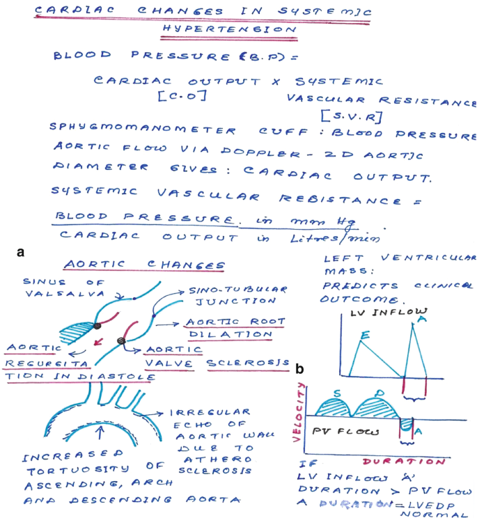 Systemic Hypertension and Echocardiographic Findings | SpringerLink