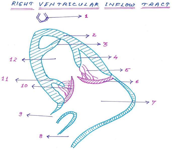 Right Ventricular Inflow Tract (RVIT) View (Left Parasternal Window ...