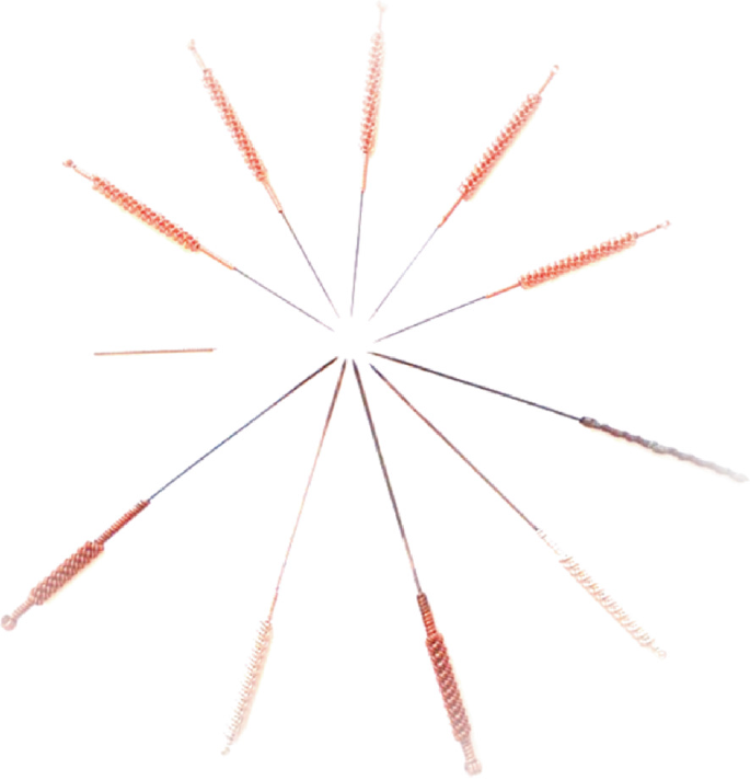 Fire Needling | SpringerLink