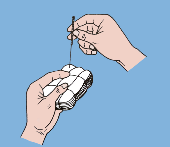 Prior to Needling | SpringerLink