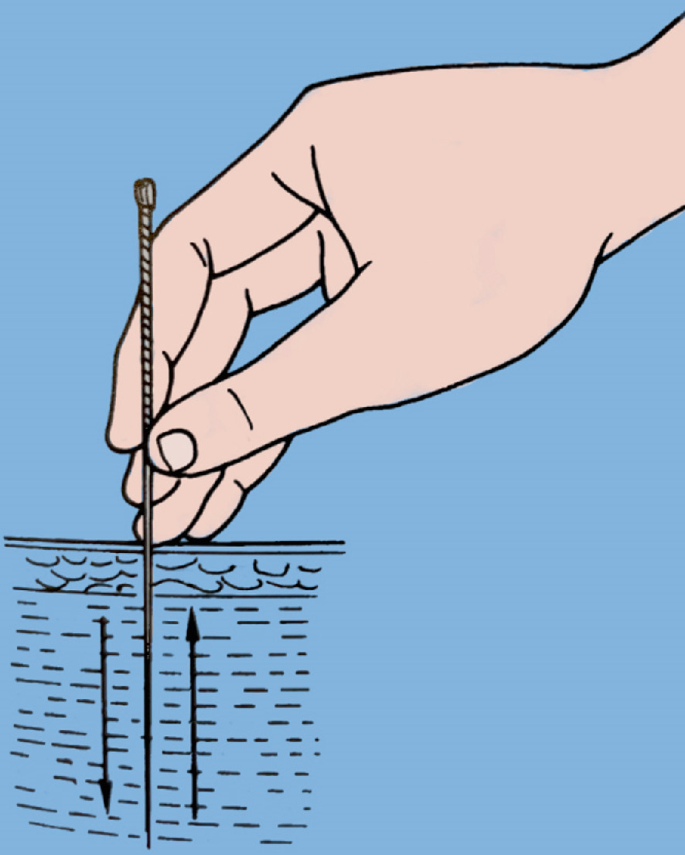 Basic Needling | Springer Nature Link (formerly SpringerLink)