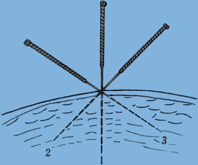 Classical Needling: Huang Di Nei Jing and Nanjing | SpringerLink