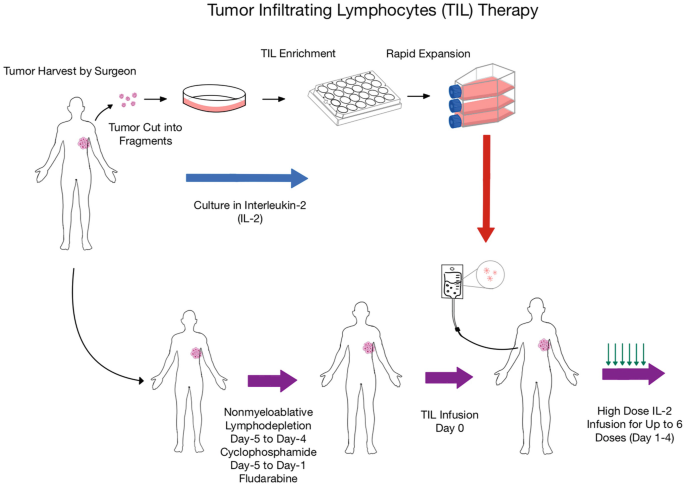 Tumor-Infiltrating Lymphocyte (TIL) Therapy | SpringerLink