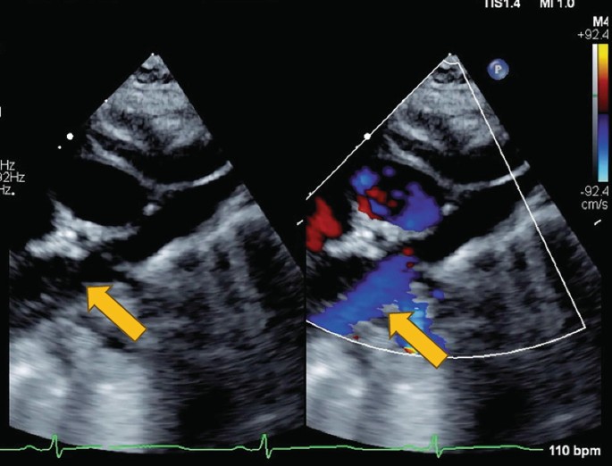 Systemic and Pulmonary Venous Abnormalities | Springer Nature Link