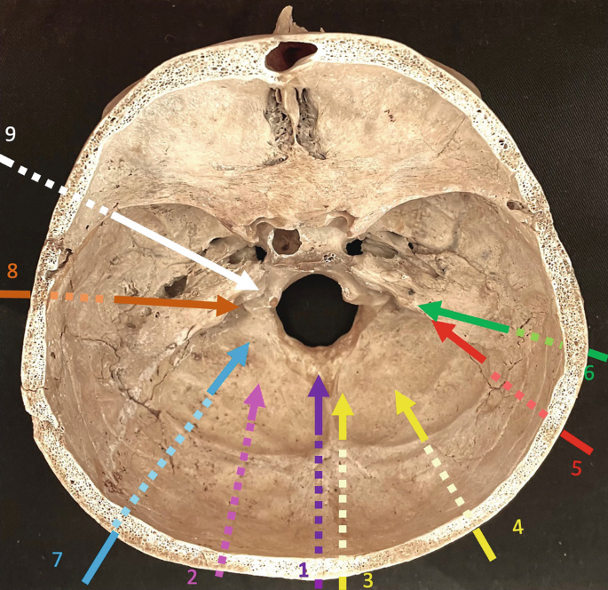 Neuroanatomy and Surgical Approaches to Paediatric Posterior Fossa ...