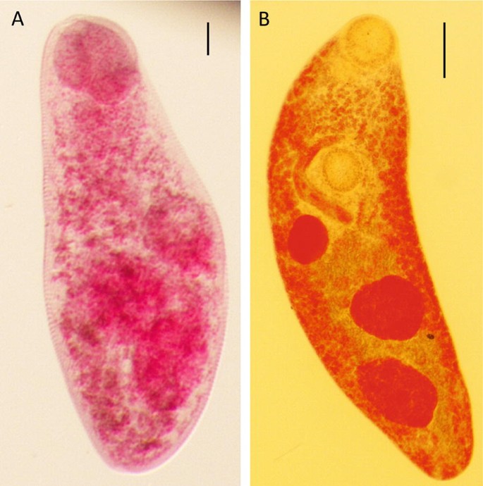 Echinostomes and Other Intestinal Trematode Infections | SpringerLink