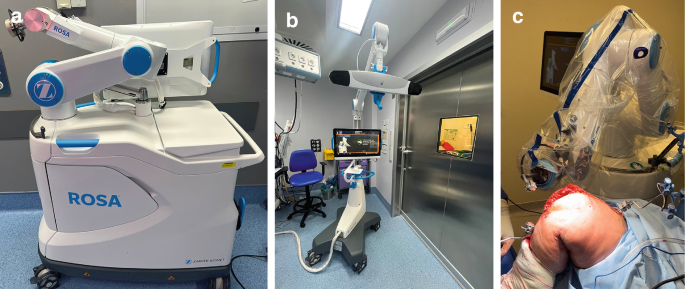 Robotic-Assisted Revision Total Knee Arthroplasty | SpringerLink