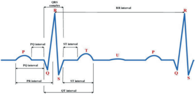Detection of Obstructive Sleep Apnea Based on Deep Learning Models from ECG Signals: A Review ...