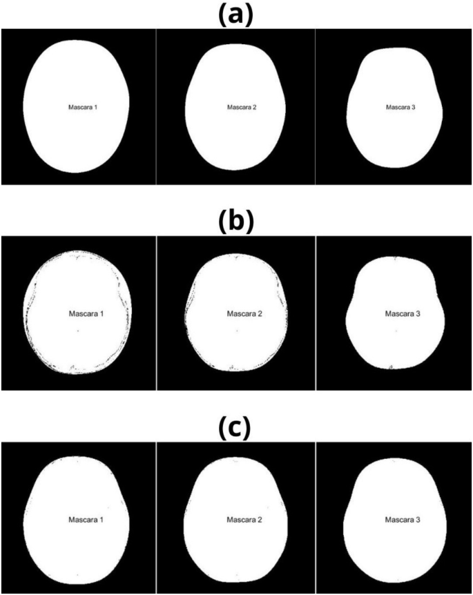 Geometric Perception of the Brain: A Classical Approach Using Image ...