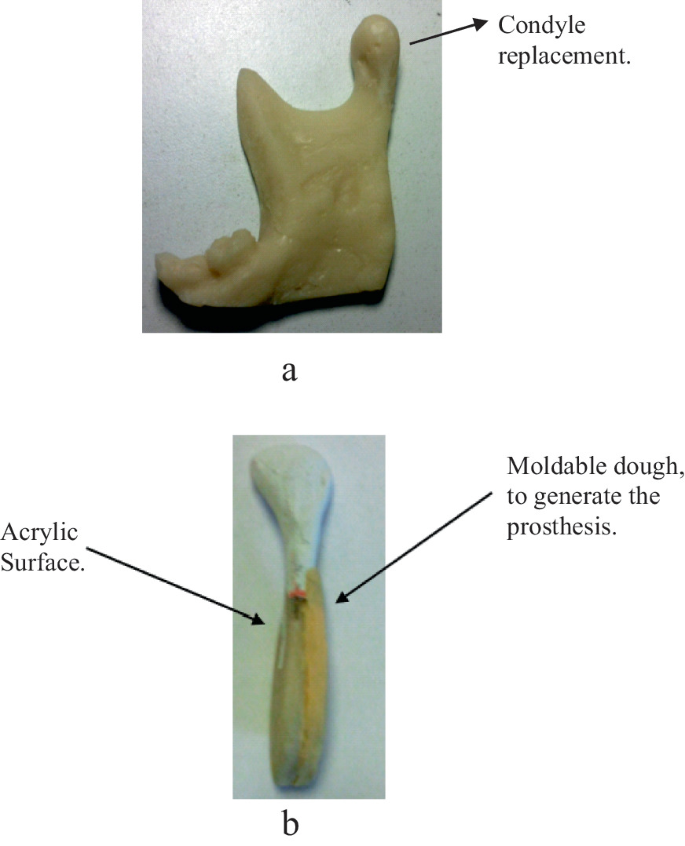 Experimental Dynamic Testing for Wear of TMJ Prosthesis Component in a ...