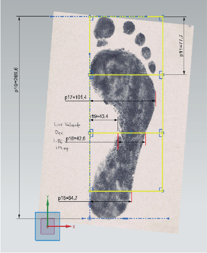 Numerical Simulation of the Biomechanical Behavior of the Impacted Foot ...