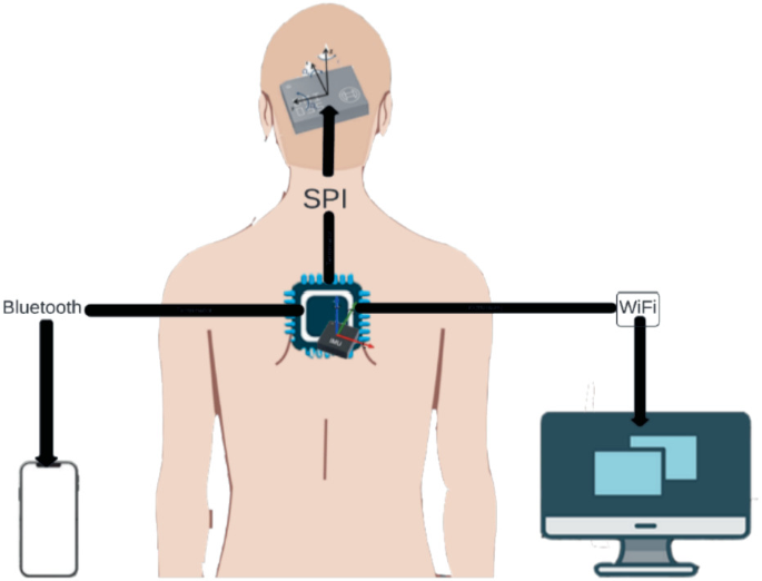 Posture Correction Device Based on IMU Sensors and CNN | SpringerLink