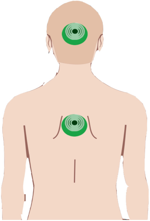 Posture Correction Device Based on IMU Sensors and CNN | SpringerLink