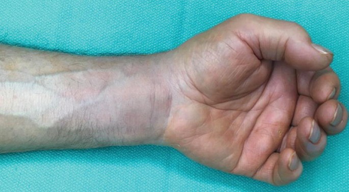 Fundamentals of Hand Examination | SpringerLink