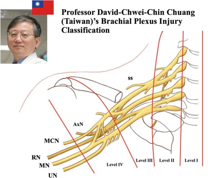 Fundamentals of Adult Brachial Plexus Reconstruction | SpringerLink