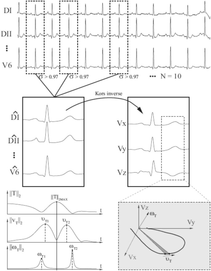 Predictive Diagnosis of Hypertrophic Cardiomyopathy Using Novel Dynamic ...