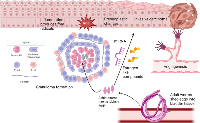 Schistosoma haematobium: A Pathophysiological Review from Chronic ...