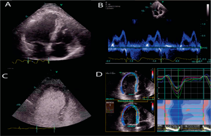 Heart Disease Detection Using Deep Learning: A Survey | SpringerLink