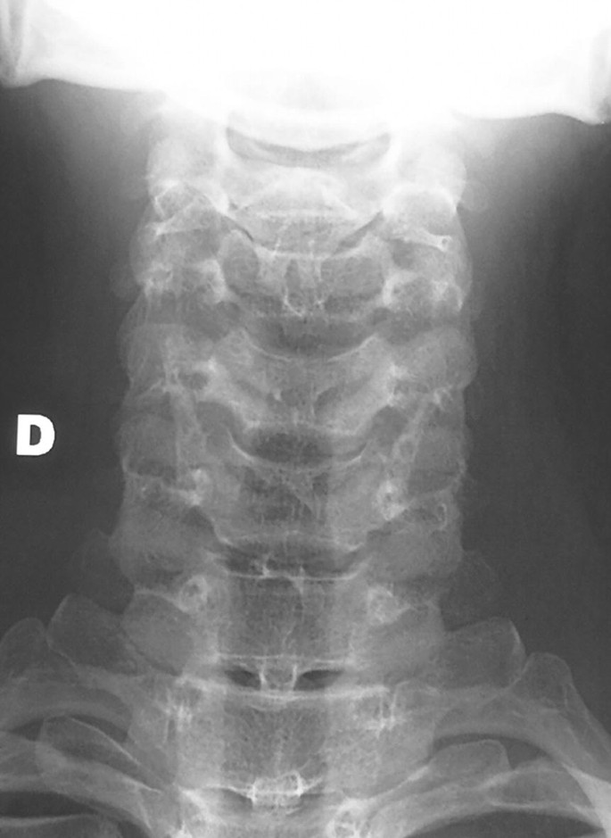 Spine Trauma | Springer Nature Link