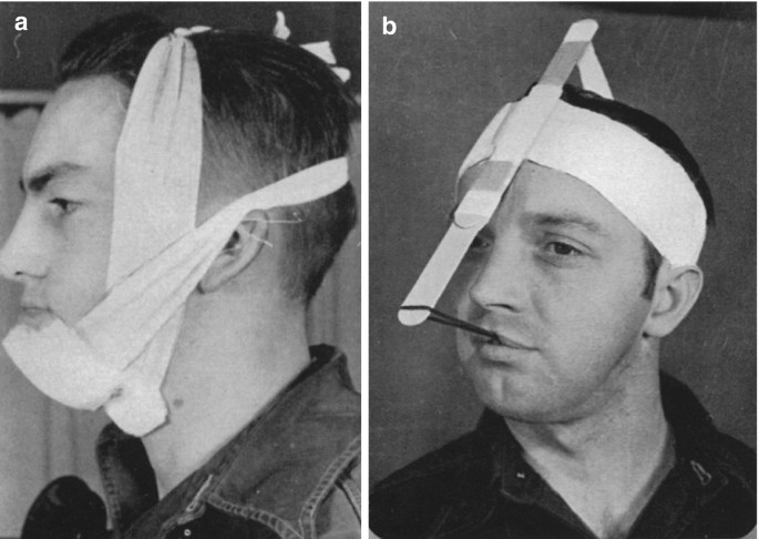 Emergency Treatment of War Injuries of the Face and Jaws. Annals of ...