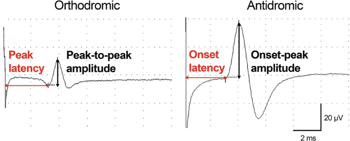 Basic Principles of Nerve Conduction Studies | SpringerLink