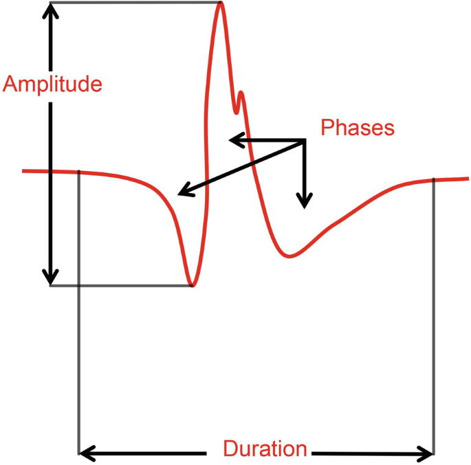 Needle Electromyography (EMG) | Springer Nature Link (formerly ...