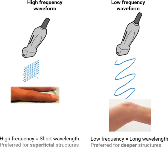 Basic Clinical Ultrasound Principles | SpringerLink