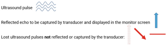 Basic Clinical Ultrasound Principles | SpringerLink