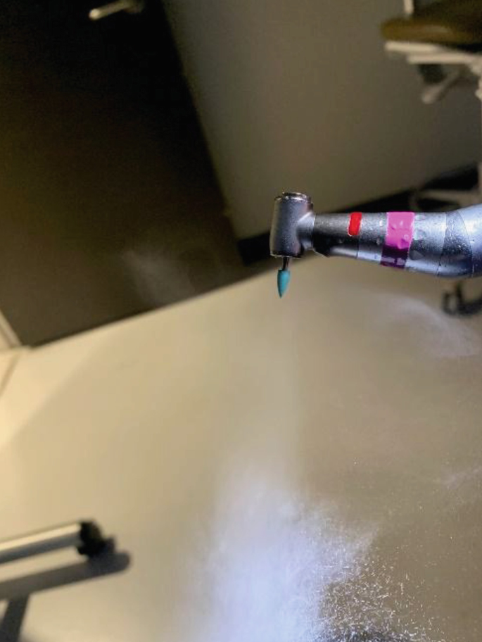 Aerosols in Dentistry | SpringerLink