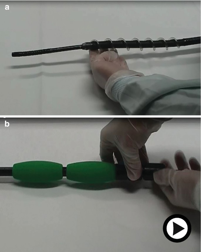 Spiral Enteroscopy | SpringerLink