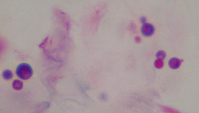 Malassezia Yeasts in Animals in the Next-Generation Sequencing Era ...