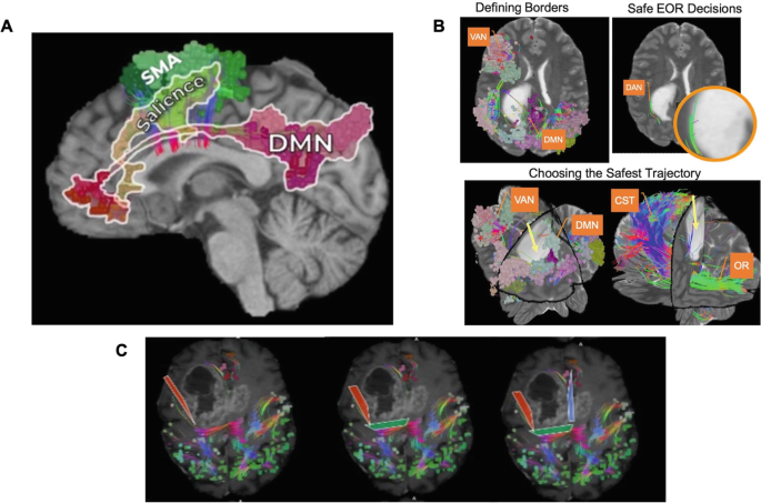 The Brain Connectome for Clinical Neuroscience | Springer Nature Link ...