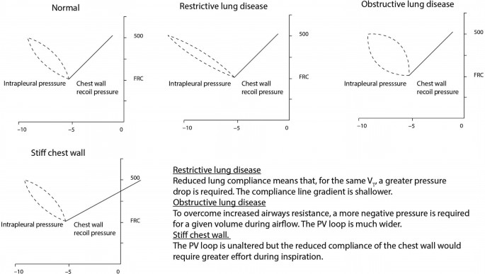Respiratory: Pressure-Volume Loops | SpringerLink