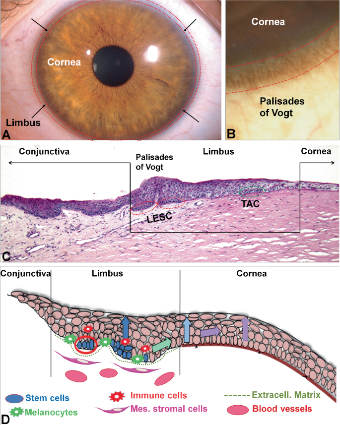 Limbal Stem Cell Deficiency | Springer Nature Link (formerly SpringerLink)