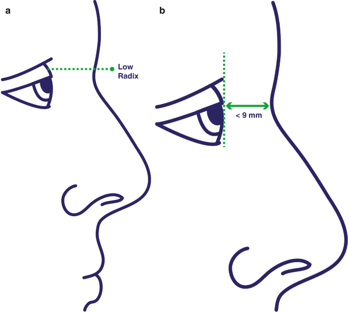 Low Radix | SpringerLink