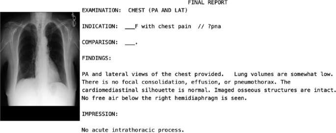 Generating Chest Radiology Report Findings Using a Multimodal Method ...